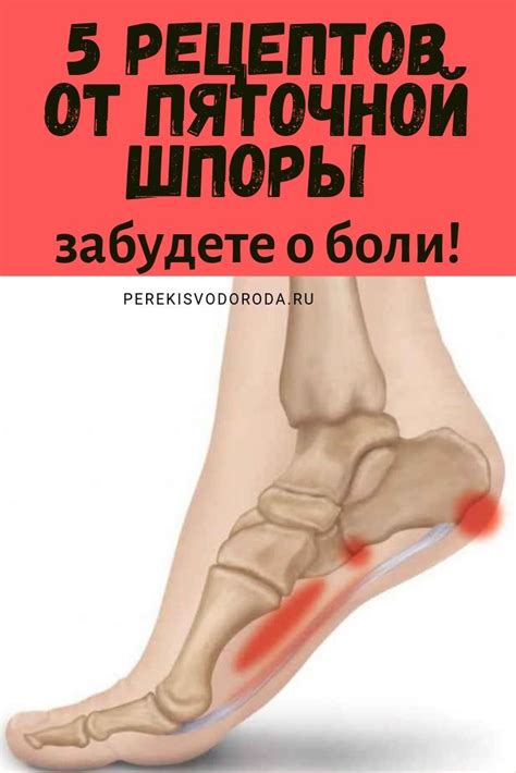 Строение пятки человека боль в пятке фото