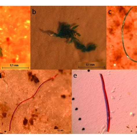 Examples Of Microplastics Identified In The Pantanal Wetlands A Pva