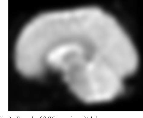 Figure 1 From Automatic Analysis Of Medical Images Based On Fractal