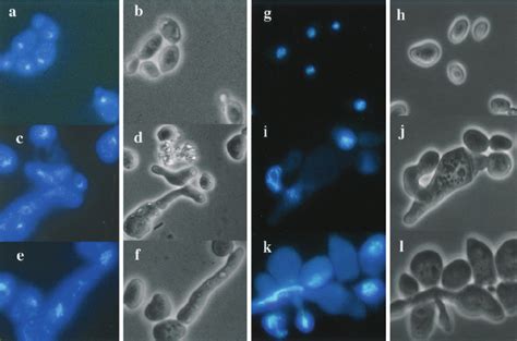 Chromatin Fragmentation Dapi Staining And Phase Contrast Of S Download Scientific Diagram