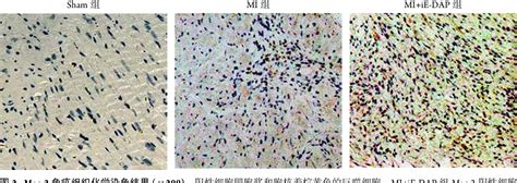 Figure 2 From Role Of Intracellular Receptor Nod1 Activation In