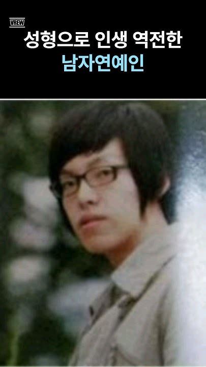 성형한 남자연예인 Youtube