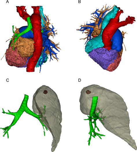 Three Dimensional Reconstruction Of The Pulmonary Arteries And Great Download Scientific