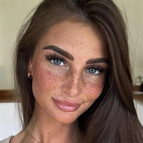 Gorgeous R Freckledgirls
