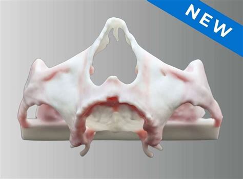 High Resolution Dental 3d Models