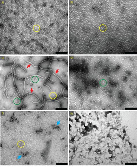Function Transmission Electron Microscopy At Imogen Repin Blog