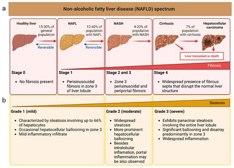 Schematic Representation Of The Grading And Staging Of Nafld Based On
