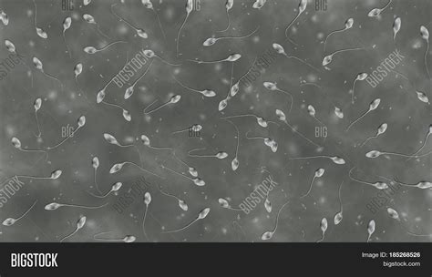 Semen Under Microscope