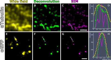 2 Structured Illumination Microscopy Increases Resolution Beyond The Download Scientific