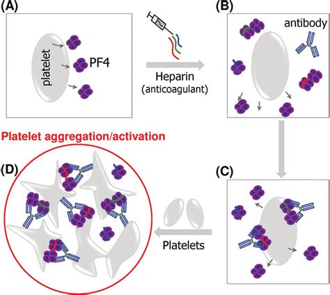 Cartoon Illustrates The Formation Of Heparin Induced Thrombocytopenia Download Scientific