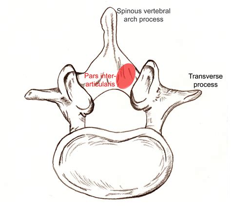 Anatomía De La Pars Interarticular