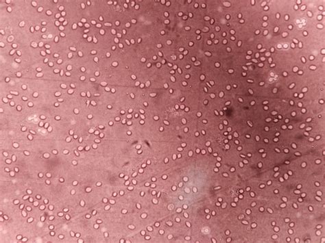 10 Immagini Foto Stock Oggetti 3d E Immagini Vettoriali Cerebrospinal