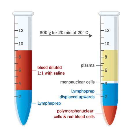 Lymphoprep™ 6x500 Ml 6x500 Ml 1858 6
