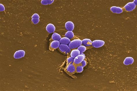 Enterococcus Faecalis Wikidoc
