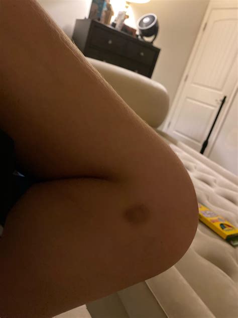 What Why Where When How R Medical