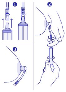 AVENT NIPLETTE Inverted Nipple Treatment Corrects Flat Nipples