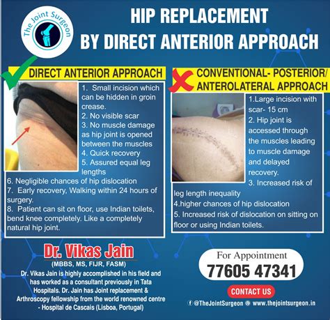 Direct Anterior Approach For Hip Replacement In In Dr Vikas Jain