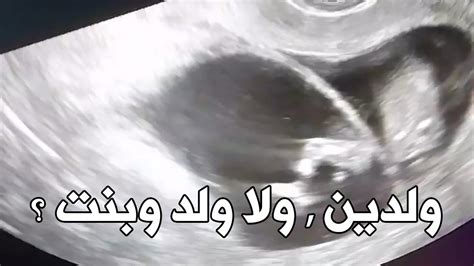 ولدين ولا ولد وبنت ؟ Youtube