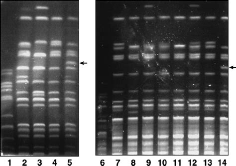 Pfge Of Apa I Digested Dnas From B Fibrisolvens Strains Dnas From The