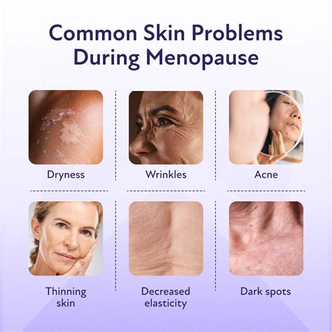Menopause And Dry Skin Symptoms Causes And Treatment