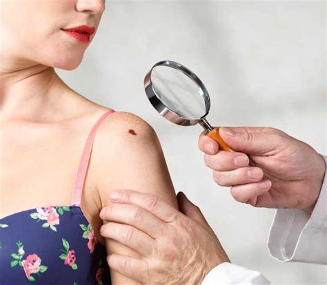 Types Of Birthmarks And Their Meanings Based On Shapes And Location