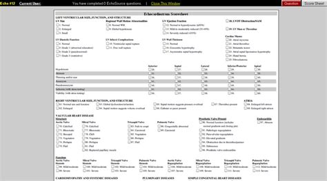 Ecgsource Echosource