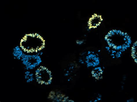 Dna Mismatch Repair Lab Idibell