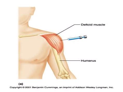 Axilla Brachial Plexus Ppt
