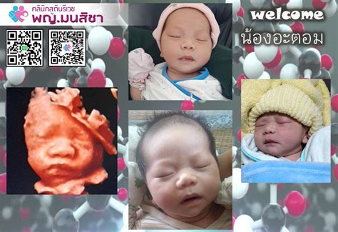 🎉 ยินดีต้อนรับ “น้องอะตอม” นะคะ 🎉 🎀 อัลตราซาวน์ 3 มิติ 4 มิติ ทำให้พ่อแม่สามารถเห็นลูกน้อยได้