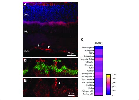 Localization Of Vesicular Polyamine Transporter Slc18b1 In Mouse