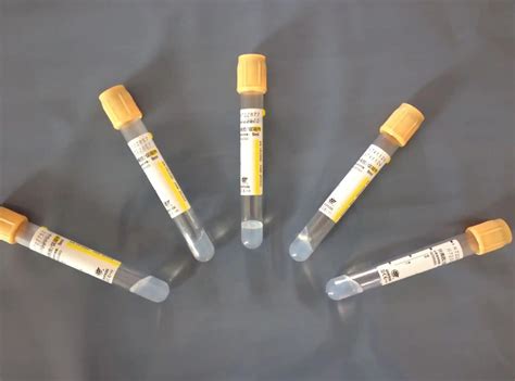 What Is Serum Separator Tube