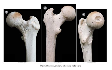 Diagram Of Proximal End Of Femur Quizlet