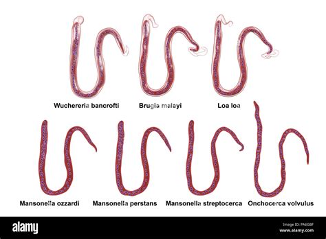 Comparison Of Microfilariae Morphology Computer Illustration Showing