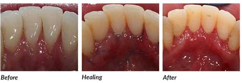 Microsurgery Dr Sanchez