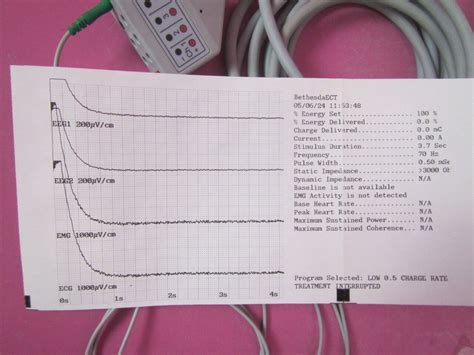 Used Somatics Inc Thymatron System Iv Electroconvulsive Ect Shock Therapy Device W Cables