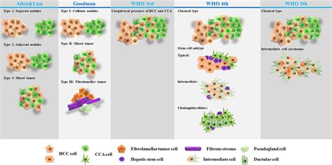 Combined Hepatocellular Cholangiocarcinoma Biology Diagnosis And