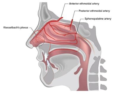 Epistaxis Practice Essentials Anatomy Pathophysiology