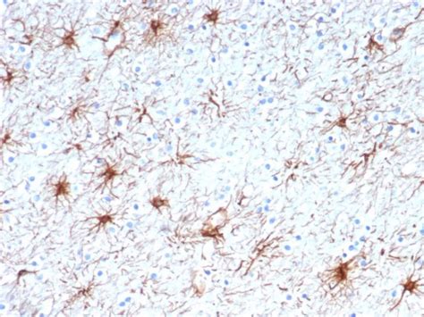 Gfap Astrocyte And Neural Stem Cell Marker Monoclonal Antibody Gfap6882 2670 Msm22 P1