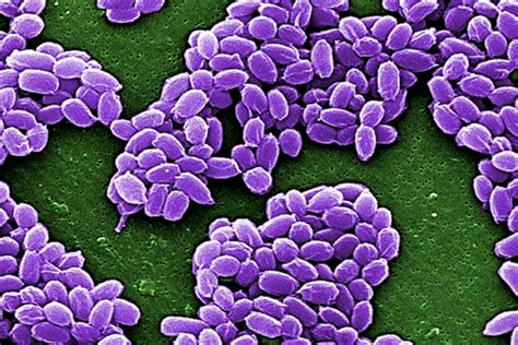 Chemists Recruit Anthrax To Deliver Cancer Drugs Mit News Massachusetts Institute Of Technology