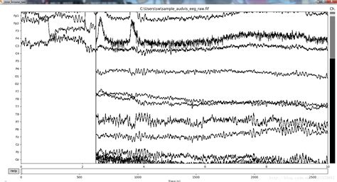 Mne Python学习之一 入门介绍mne Cnt文件 Csdn博客 Mne Python学习之一 入门介绍mne Cnt文件 Csdn博客
