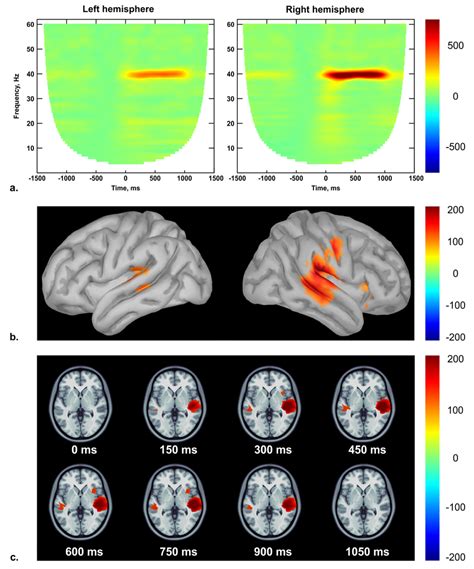 40 Hz Auditory Steady State Response Assr Mapping Grand Average A Download Scientific