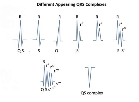 Qrs Right Axis Deviation Rad • Litfl • Ecg Library Diagnosis