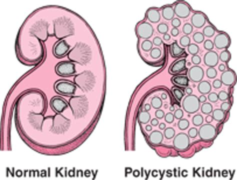 Renal Part 1 Flashcards Quizlet