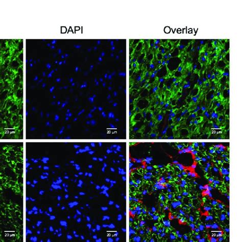 Pulmonary Hypertension Ph Induces Myocyte Disarray In Vivo A
