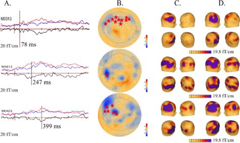 At Risk Group N 13 A Averaged Combined Gradiometer Waveforms For Download Scientific