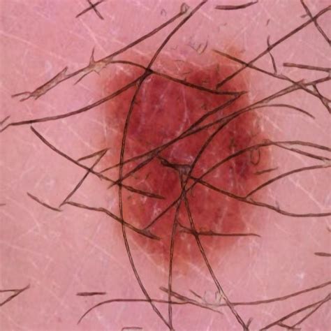 How To Overlay Two Images In Python Stack Overflow