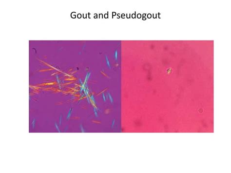 Polarizing Light Microscopy Pptx Physics Science