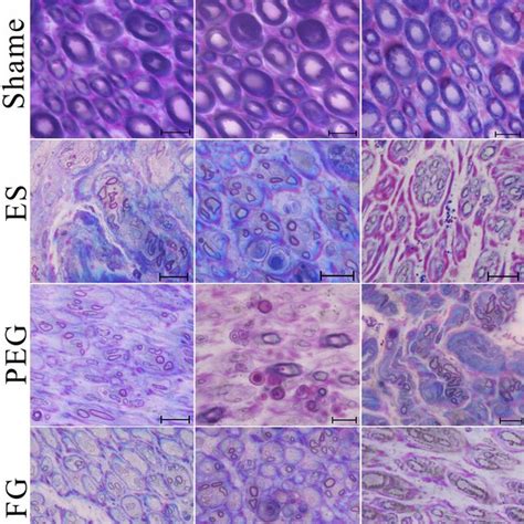 Cross Section Of In Distal Sciatic Nerve Stained By Ma Hayat Method