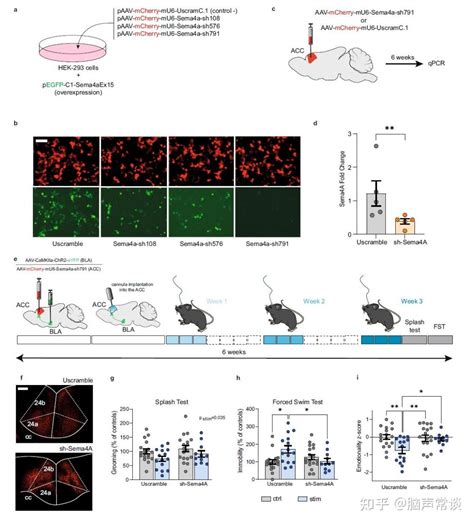 基底外侧杏仁核 前扣带回通路调控慢性疼痛合并抑郁的神经环路机制 知乎
