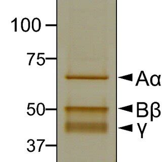 Analyses Of The Purified Rfib The Rfibs Purified By Cupric Download Scientific Diagram